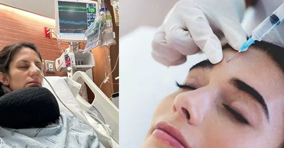 Migraine Pain में Botox Treatment करवा सकते हैं, Does Botox Injection ...