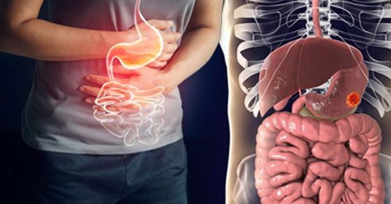 Last Stage Stomach Cancer Pain Area: Pet Ka Cancer Kaise Pata Chalega ...