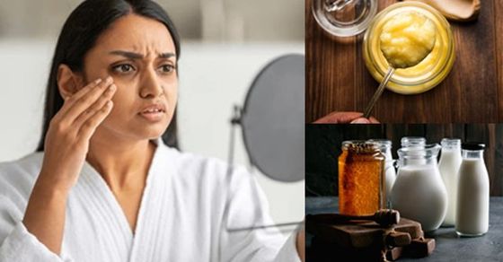 Dry Skin Hone Par Kya Kare, Dry Skin Me Kya Lagana Chahiye - BoldSky