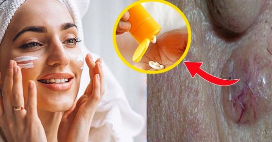 Sunscreen Side Effect On Skin:सनस्क्रीन लगाते वक्त 1 गलती,Skin Rashes ...