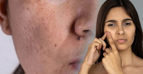 Face Bloating Causes: चेहरे पर सूजन क्यों होती है, Swealing Reason ...