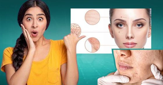 Skin Congestion Treatment: चेहरे के छेद बंद क्यों हो जाते है, Clogged ...