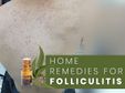 How To Treat Intertrigo: Safe And Effective Home Remedies - Boldsky.com