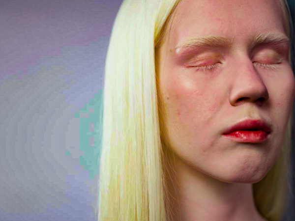 पेल लोगों की वो प्रॉब्लमस जिनसे छुटकारा पाना है मुश्किल | know about ...