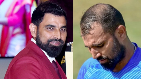 गंजे हो रहे क्र‍िकेटर मोहम्‍मद शमी के सिर पर कैसे आए घने बाल? जानें क ...