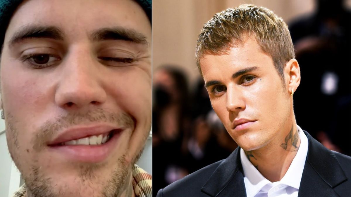 Ramsay Hunt Syndrome: जस्टिन बीबर को हुई थी ये खतरनाक बीमारी, जब आधा ...