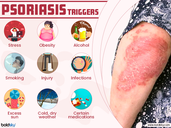 Biologics: What Are They & How They Help Treat Psoriasis - Boldsky.com