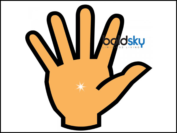 Star Sign on Palm Meaning : ഉള്ളം കൈയ്യില്‍ ഉണ്ടോ നക്ഷത്രചിഹ്നം; ഫലം ...