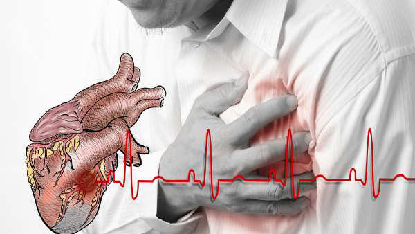 ഹൃദയാരോഗ്യത്തെ ഗുരുതരമാക്കും മിനിഹാര്‍ട്ടറ്റാക്ക്: നിങ്ങള് ...