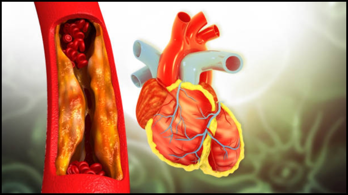 Heart Blockage: இதயத்தில் அடைப்பு ஏற்படக்கூடாதா? அப்ப இந்த விதைகளை ...