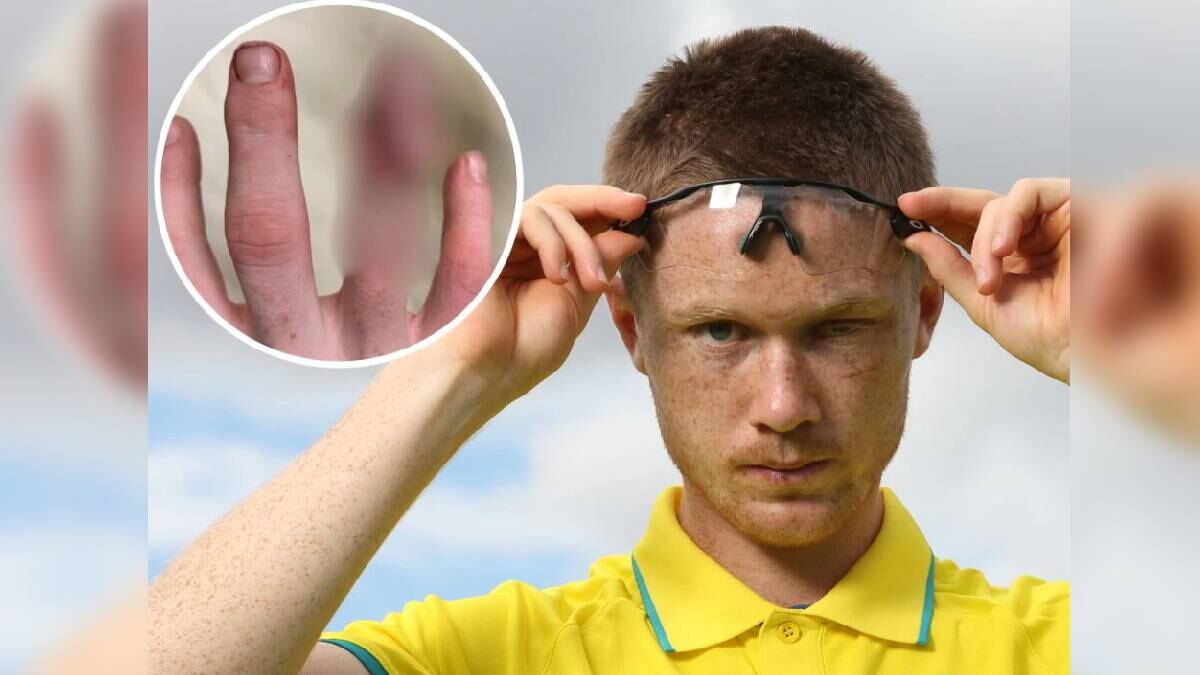 చేతి వేలునే కట్ చేసుకున్న పారిస్ ఒలింపిక్స్ ఆటగాడు.. ఎందుకో తెలిస్తే ...