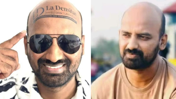 బట్టతలతో నెలకు రూ. 50 వేలు..కుర్రాళ్లు ఆలోచించుకోండి | Innovative ...