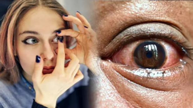 Side Effects of Wearing Colored Contact Lenses | - BoldSky